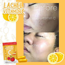 Lachel Vitamin C | Worldwide Shipping | Retail Wholesale
