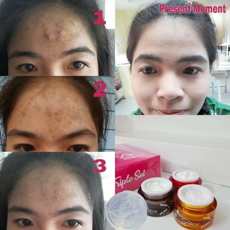 Princess Skin Care Triple Set | Worldwide Shipping |Retail & Wholesale