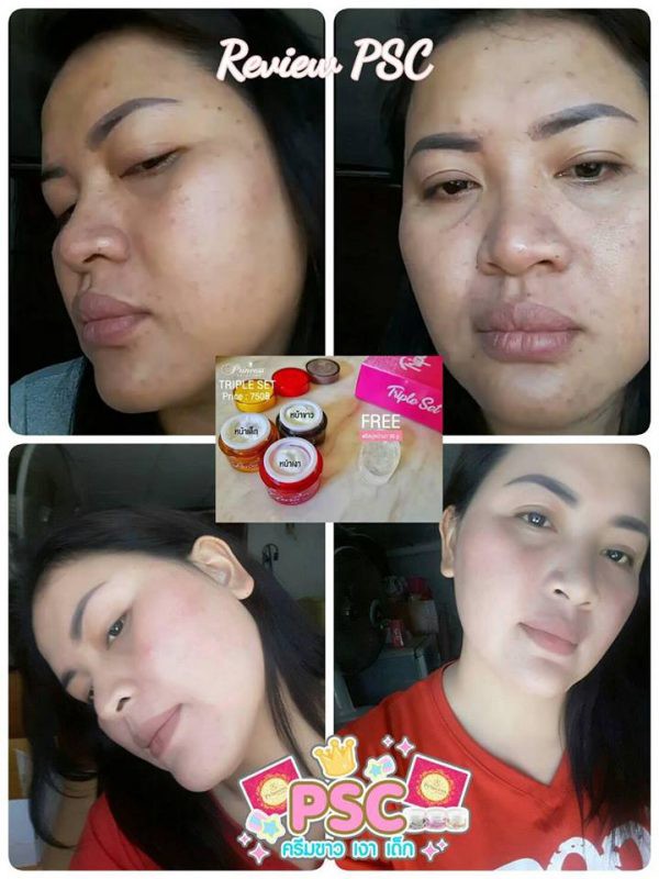 Princess Skin Care Triple Set | Worldwide Shipping |Retail & Wholesale