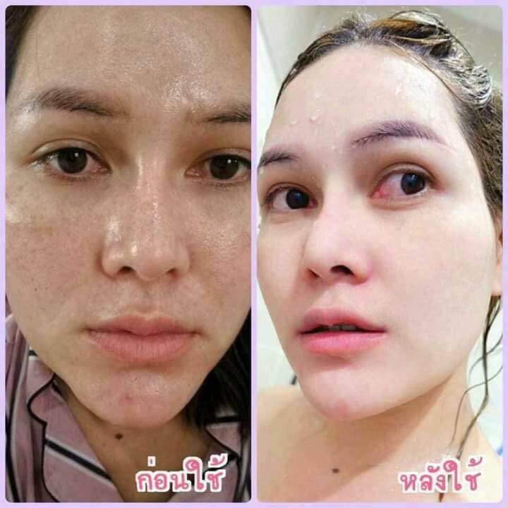 Princess Skin Care Triple Set Brightening Anti Acne | Worldwide Shipping