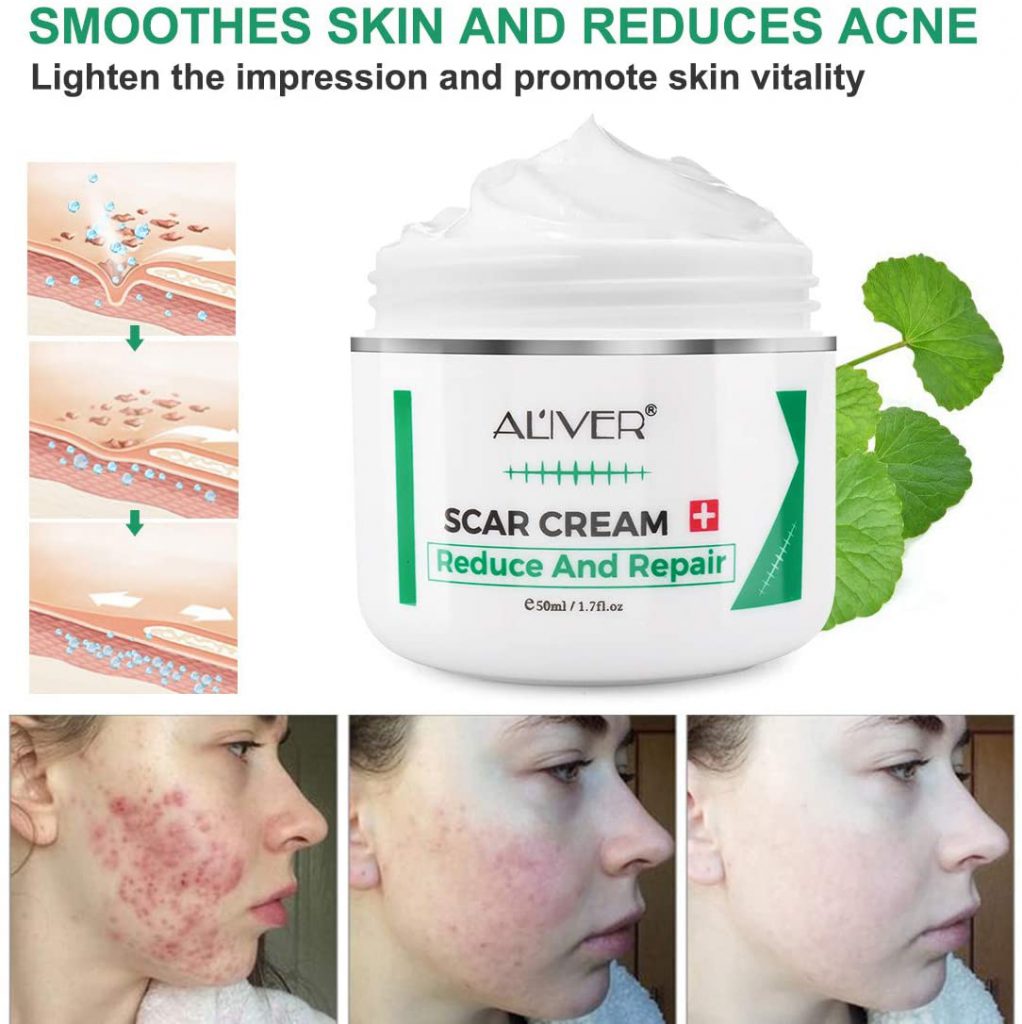 Aliver Scar Cream Reduce And Repair | Worldwide Shipping | Retail Wholesale