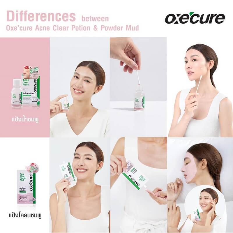 Oxe Cure Acne Clear Potion | Worldwide Shipping | Retail Wholesale