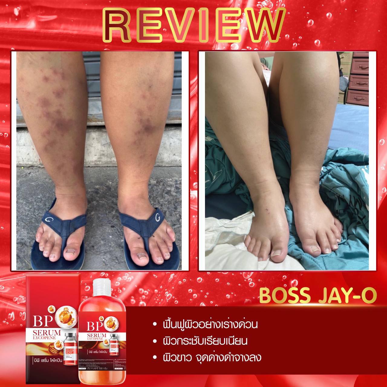 BP Serum Lycopene 500ml Body Serum | Worldwide Shipping