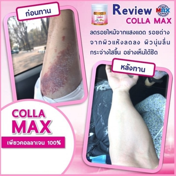 Wisamin Colla Max Plus | Worldwide Shipping | Retail & Wholesale